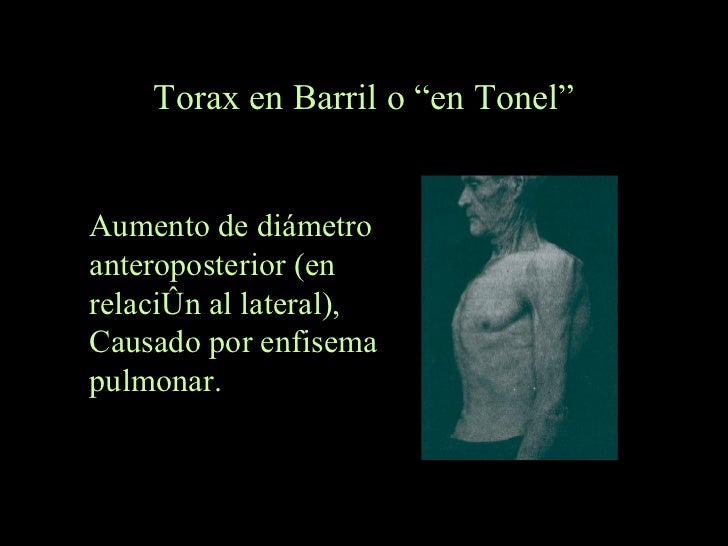 Semiologia Respiratoria