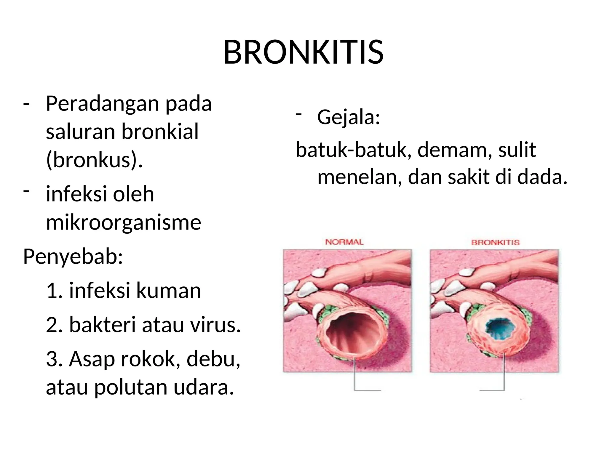 Respiratori sistem pada manusia dewasa (SMK) | PPT