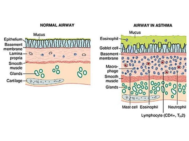 Respiratory.ppt Pathology of the respiratory system | PPT