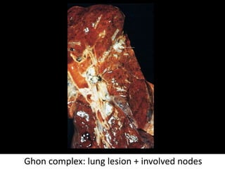 Respiratory.ppt Pathology of the respiratory system | PPT