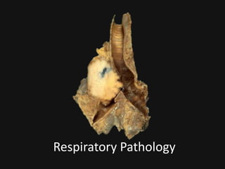 Respiratory.ppt Pathology of the respiratory system | PPT