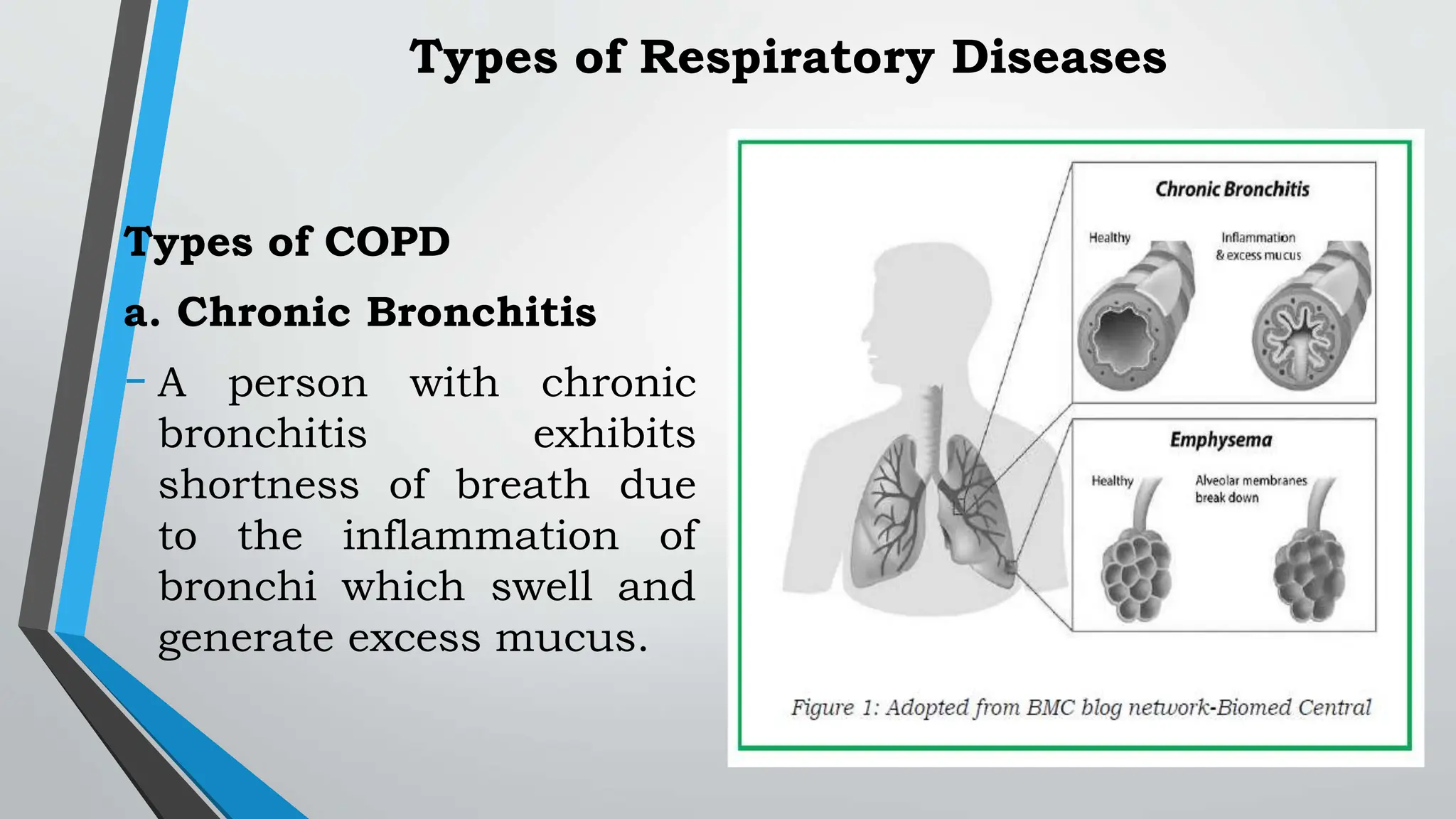 Respiratory-and-Circulatory-System-Diseases.pptx