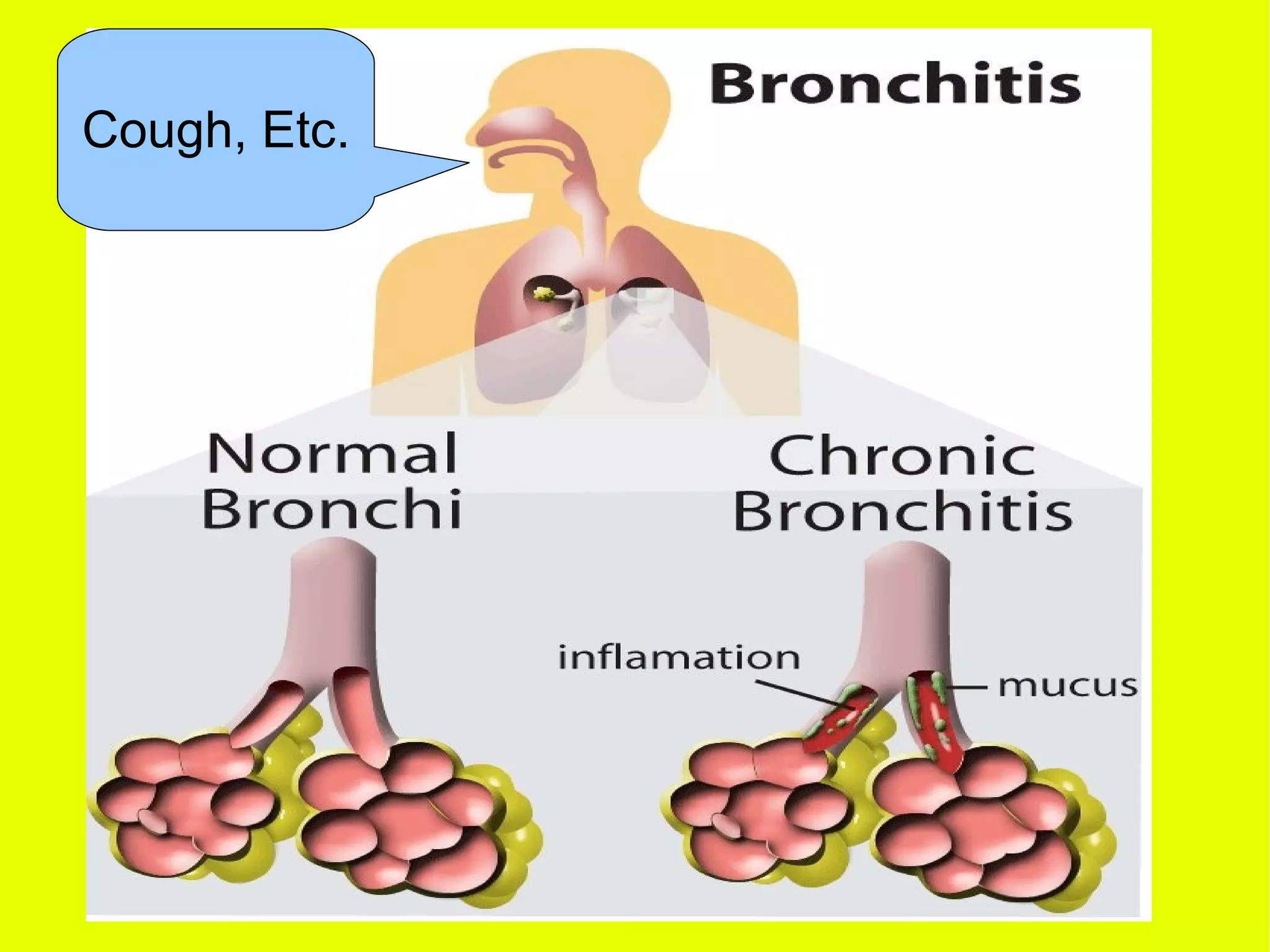 Respiratory Diseases | PPT
