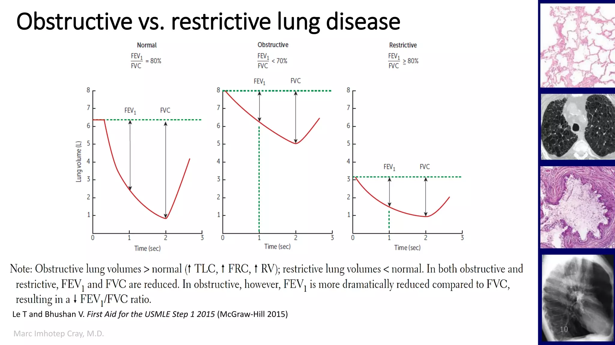 Respiratory Pathology and Pathophysiology- Global Overview | PDF