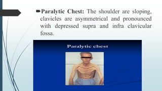 HEALTH ASSESSMENT IN RESPIRATORY SYSTEM. | PPTX