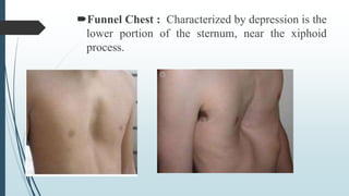 HEALTH ASSESSMENT IN RESPIRATORY SYSTEM. | PPTX