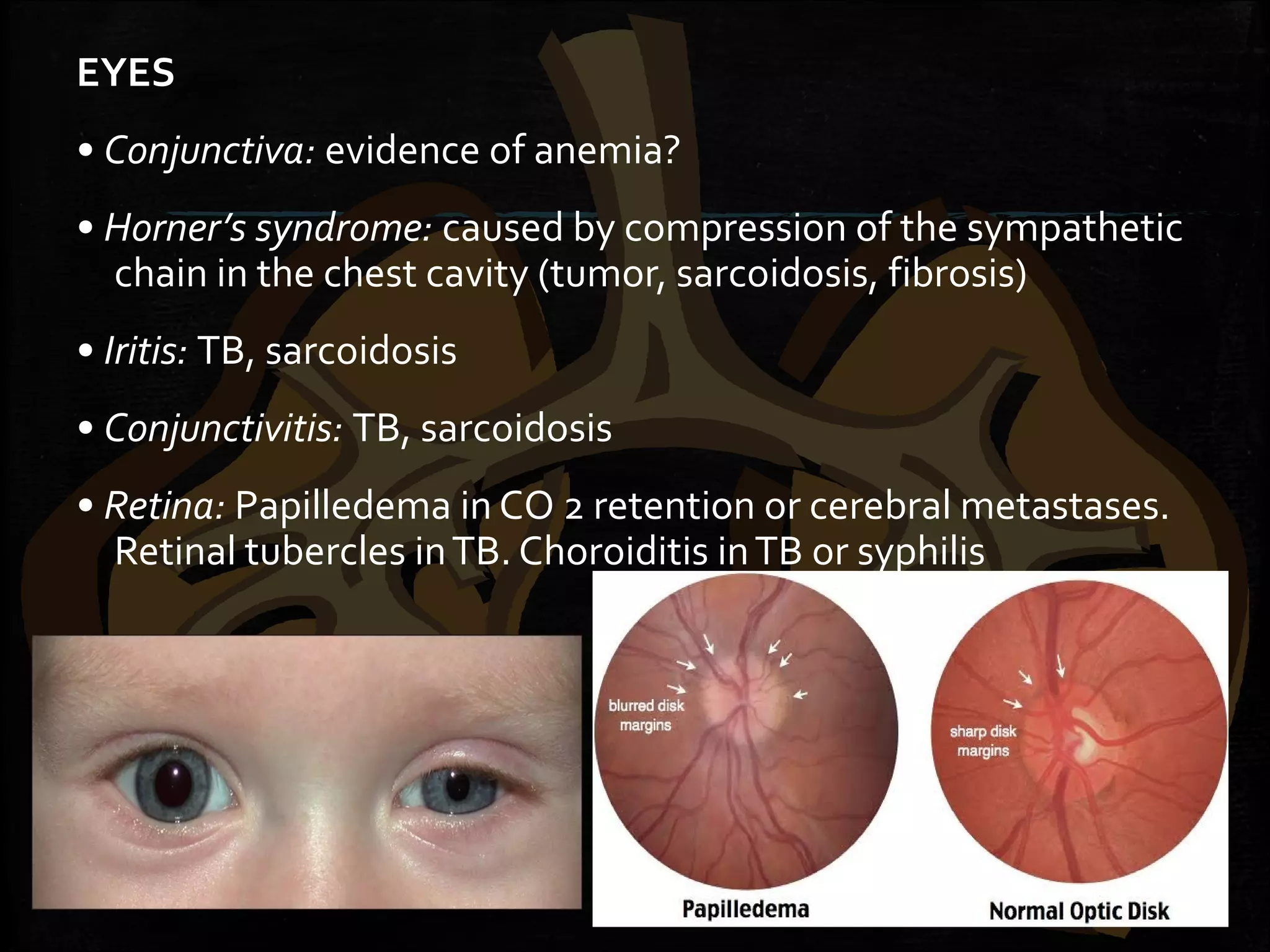 Respiratory System assessment | PPT