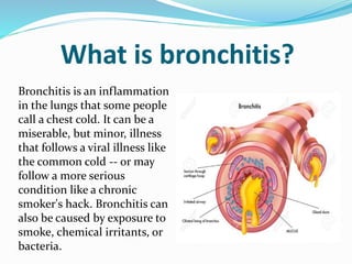 Respiratory complications | PPTX