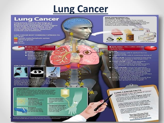 Respiratory disease and its management | PPTX