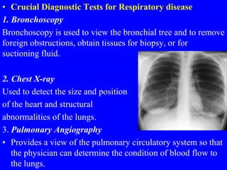 Respiratory disease | PPT
