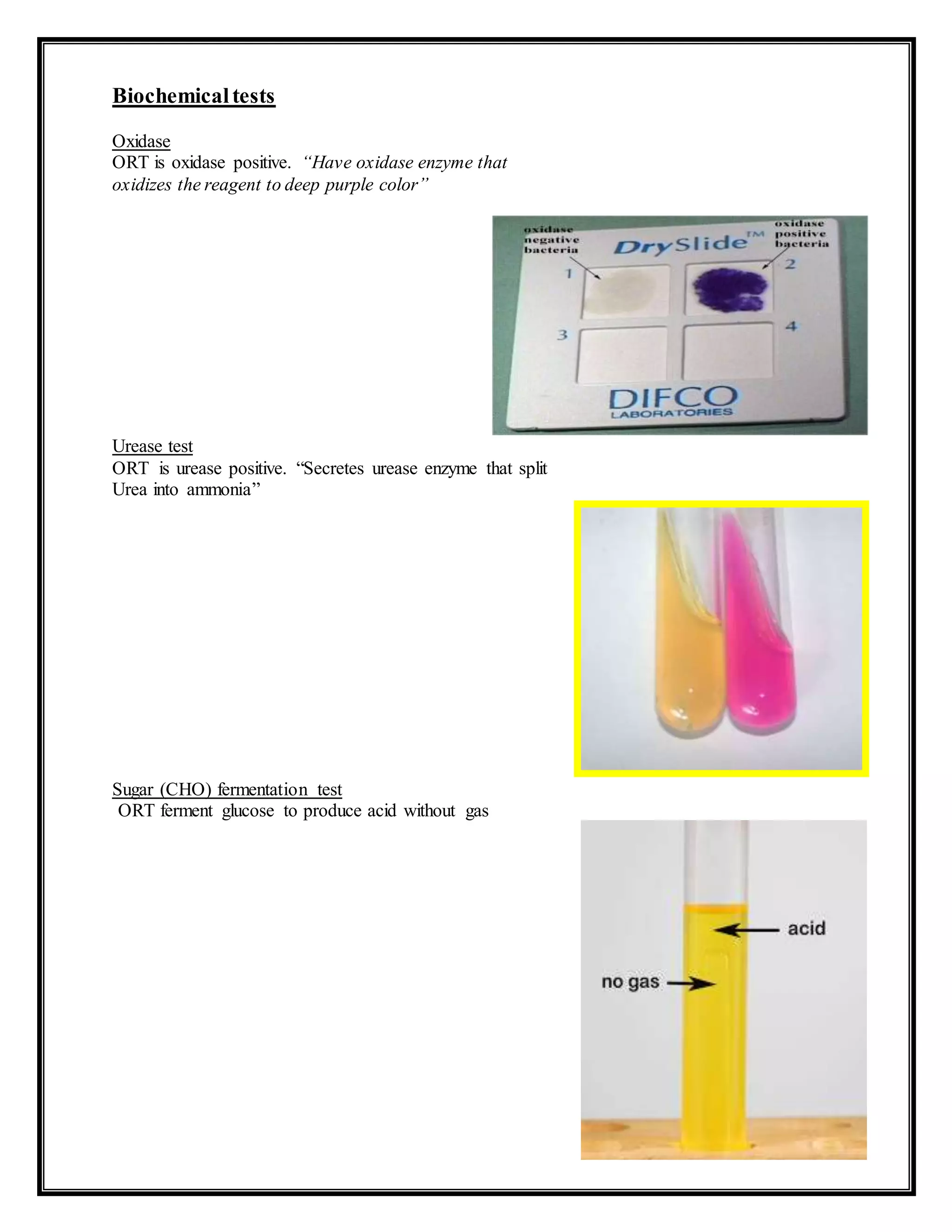 Laboratory diagnosis of bacteria causing respiratory diseases in ...