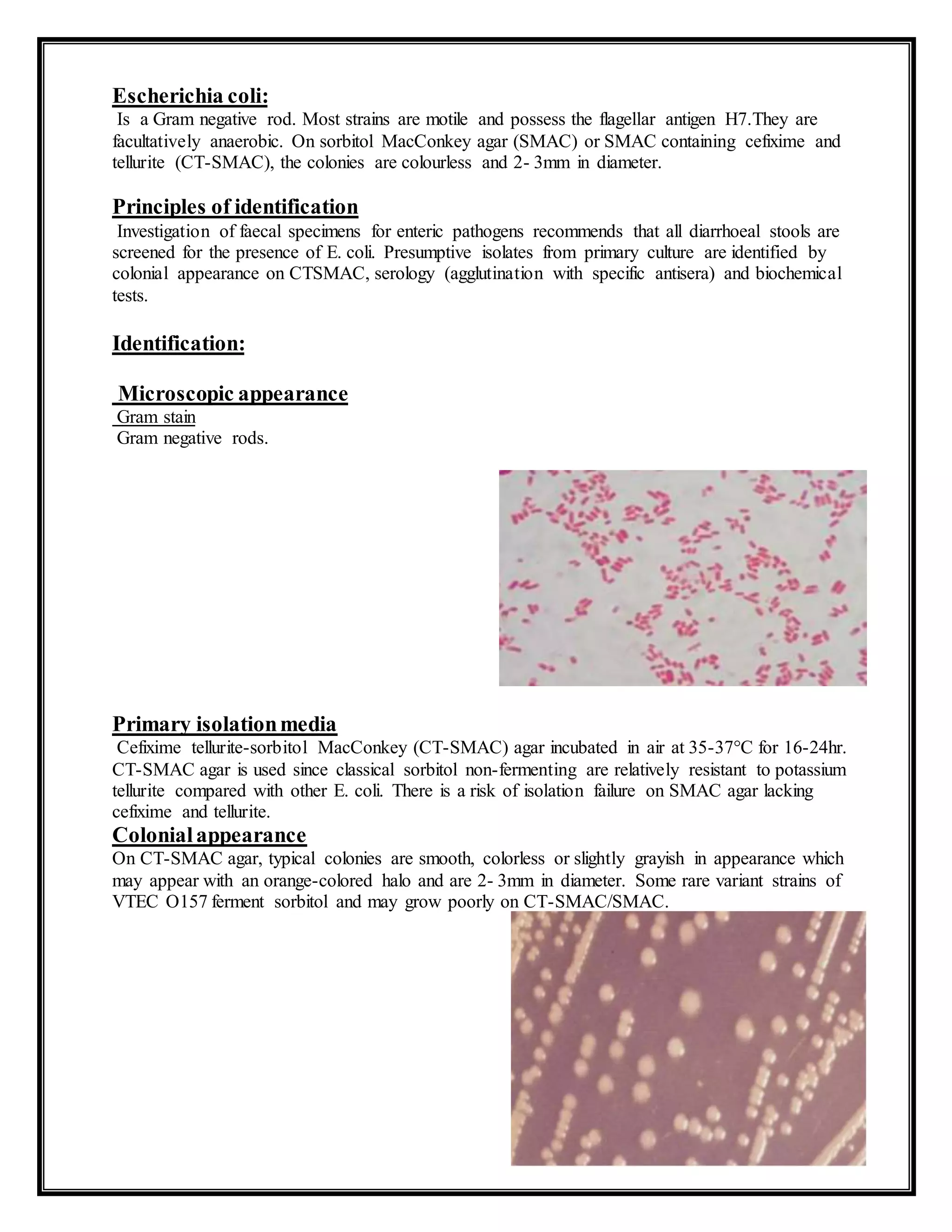 Laboratory diagnosis of bacteria causing respiratory diseases in ...