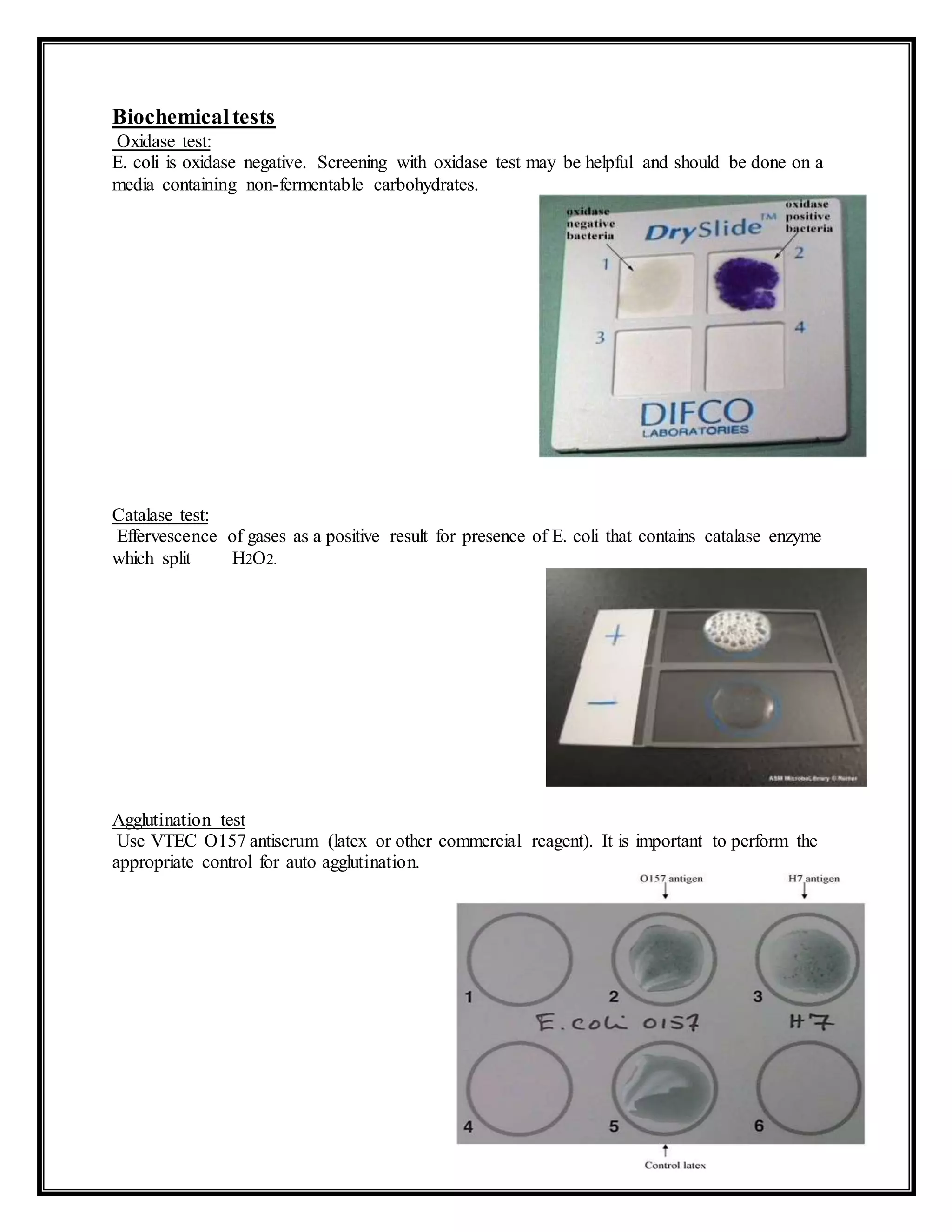 Laboratory diagnosis of bacteria causing respiratory diseases in ...