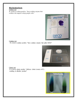 Laboratory diagnosis of bacteria causing respiratory diseases in ...