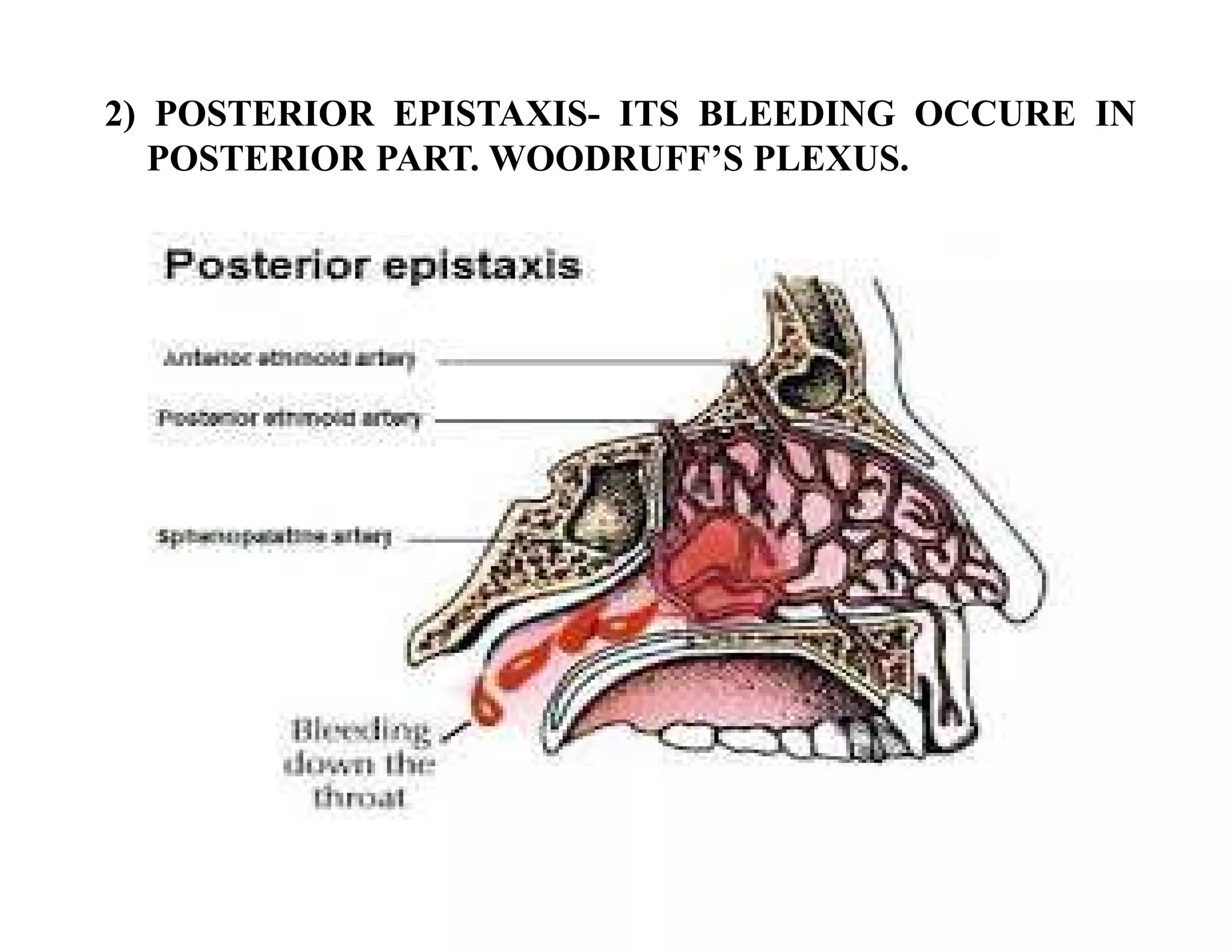 Respiratory disorders For Nursing Students By- Ahmed Sodha | PDF
