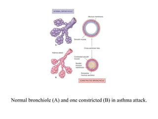 Respiratory disorders | PPTX