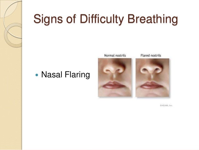 Respiratory distress