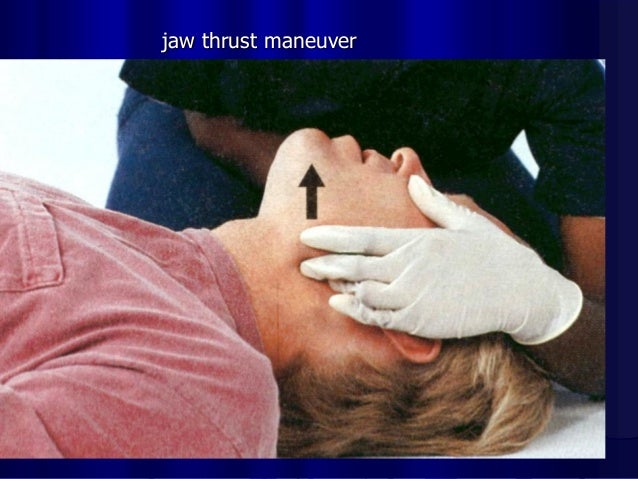 Respiratory distress