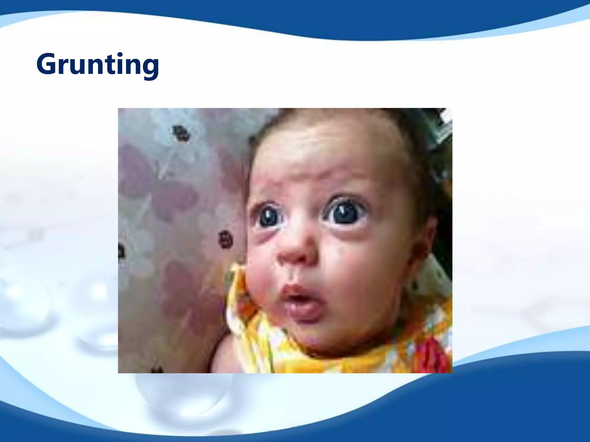 Respiratory distress in adults and paediatrics | PPTX