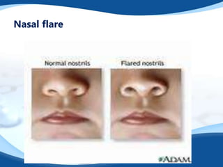 Respiratory distress in adults and paediatrics | PPTX | Lung and ...