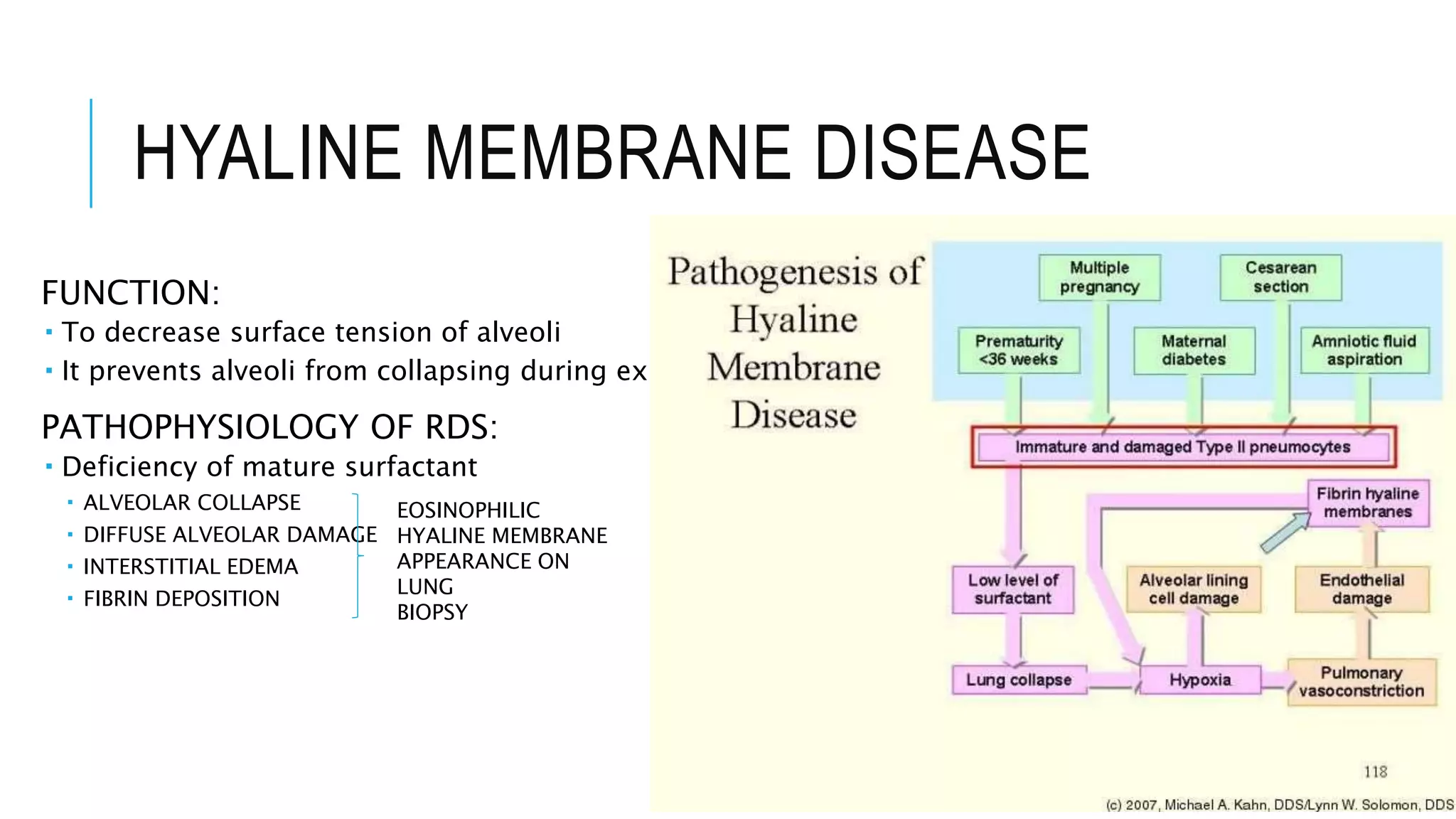 Respiratory distress in neonates.pptx