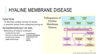 Respiratory distress in neonates.pptx