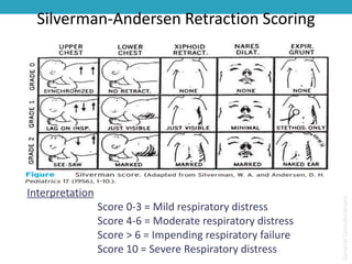 Respiratory distress in newborn | PPT