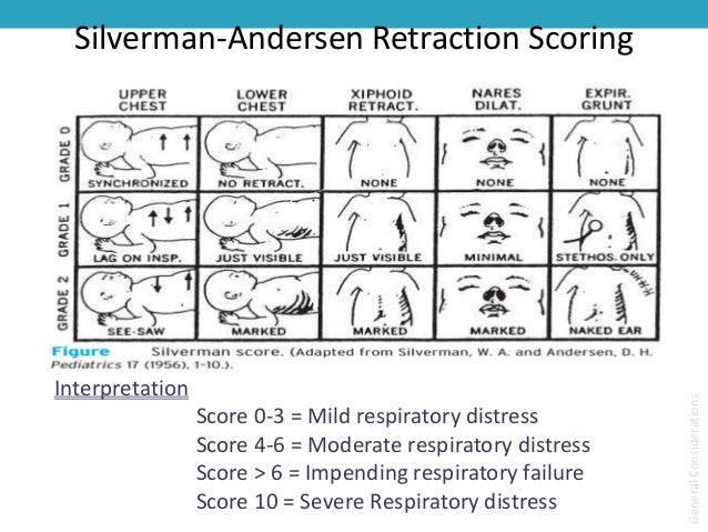 Respiratory distress in newborn