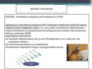 Respiratory distress in newborn | PPTX