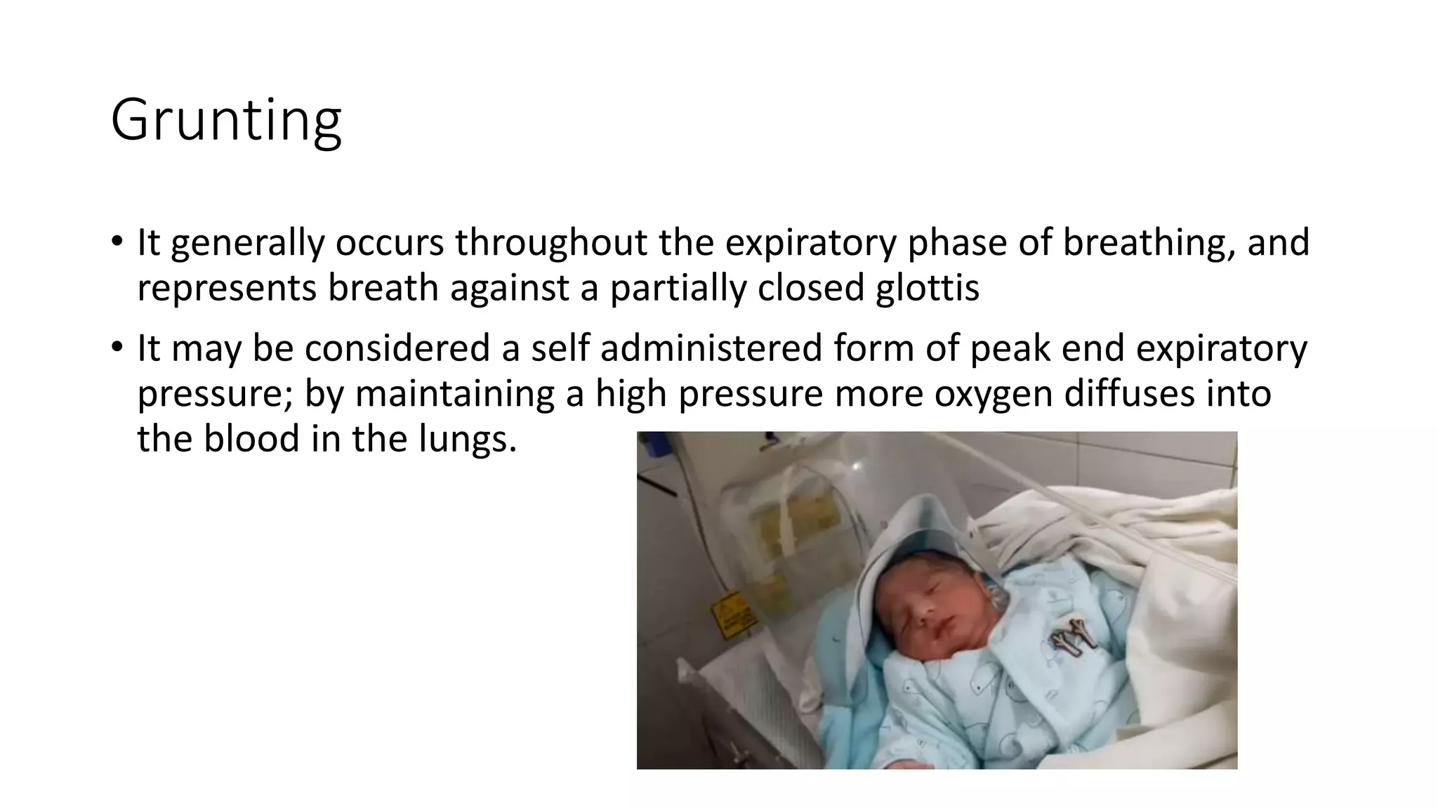 Respiratory Distress in Newborn.pptx