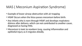 slide respiratory distress in newborn.pptx