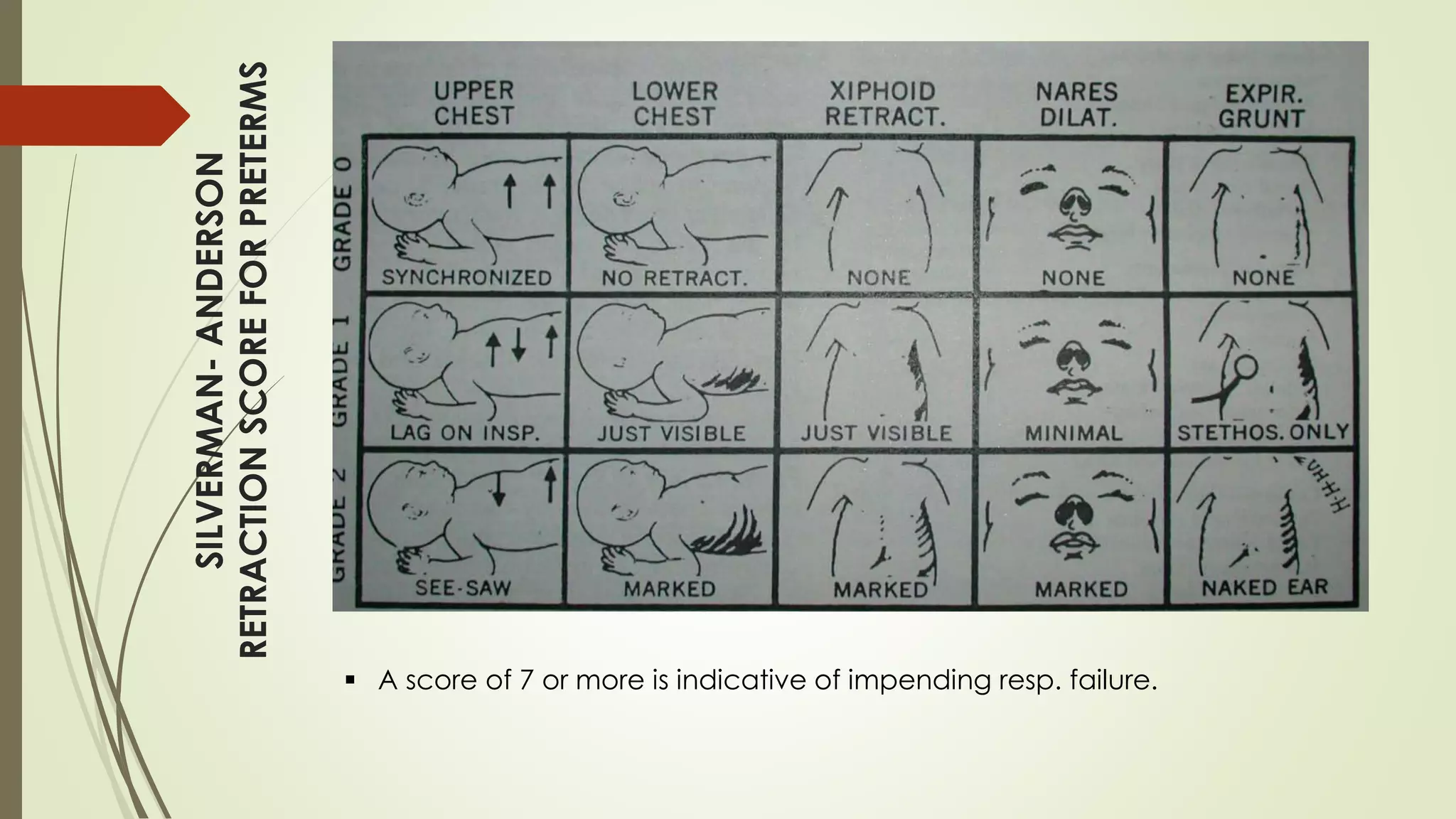 Respiratory distress in newborn | PPTX