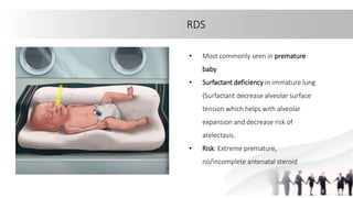 RESPIRATORY DISTRESS IN NEWBORN final.pptx