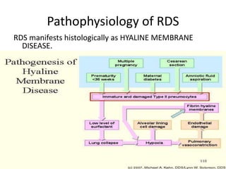 Respiratory distress in the newborn | PPTX