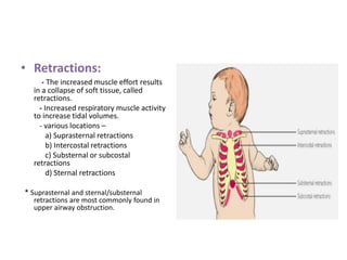 Respiratory distress and niv | PPT