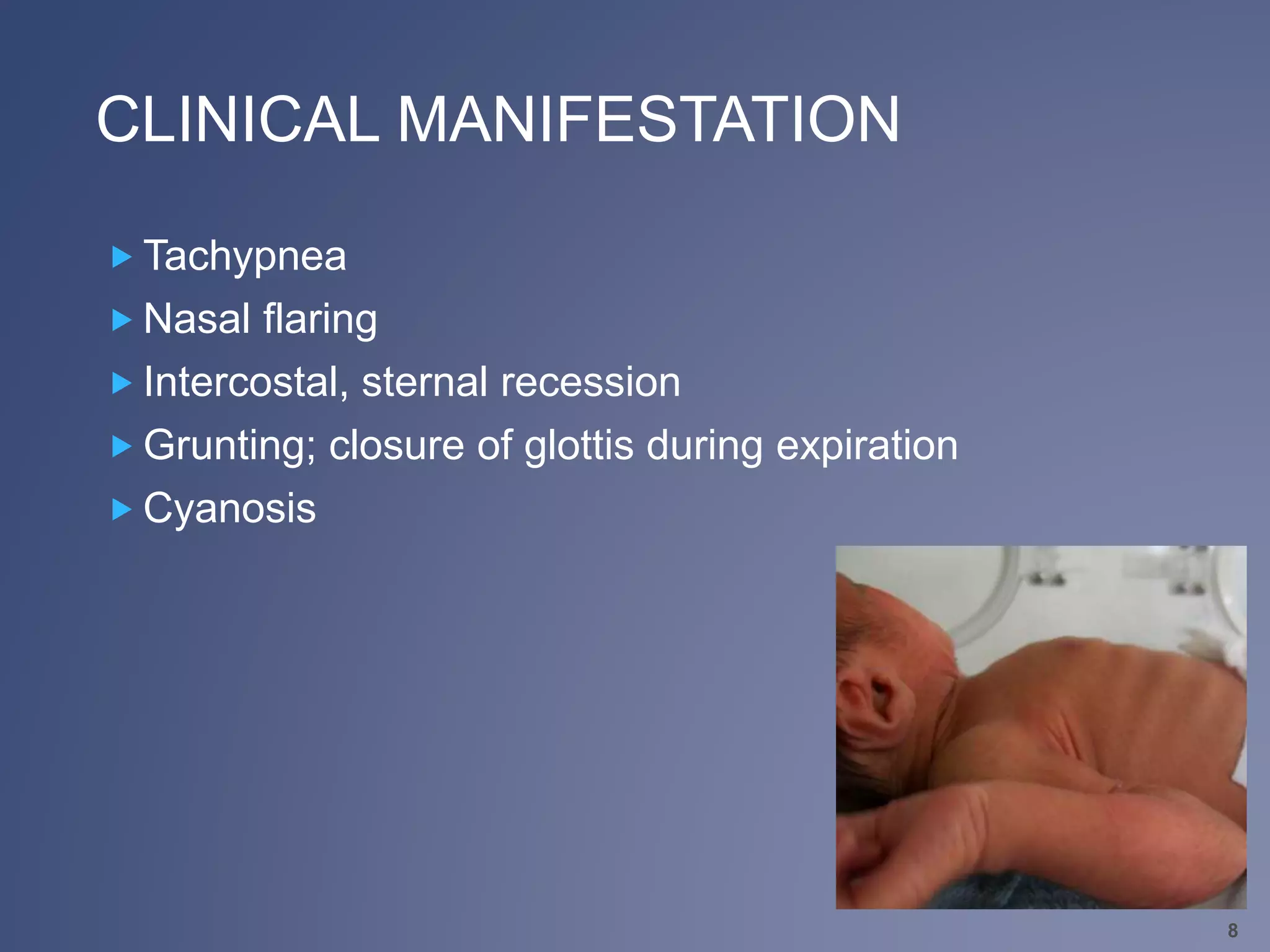 Respiratory distress of the newborn | PPTX