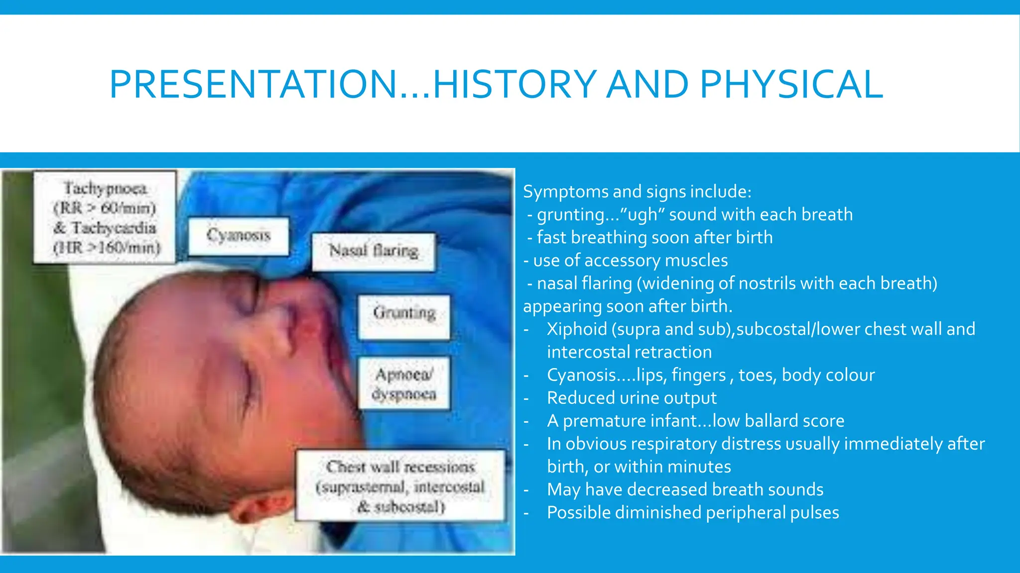 Respiratory distress syndrome^.^.pptx