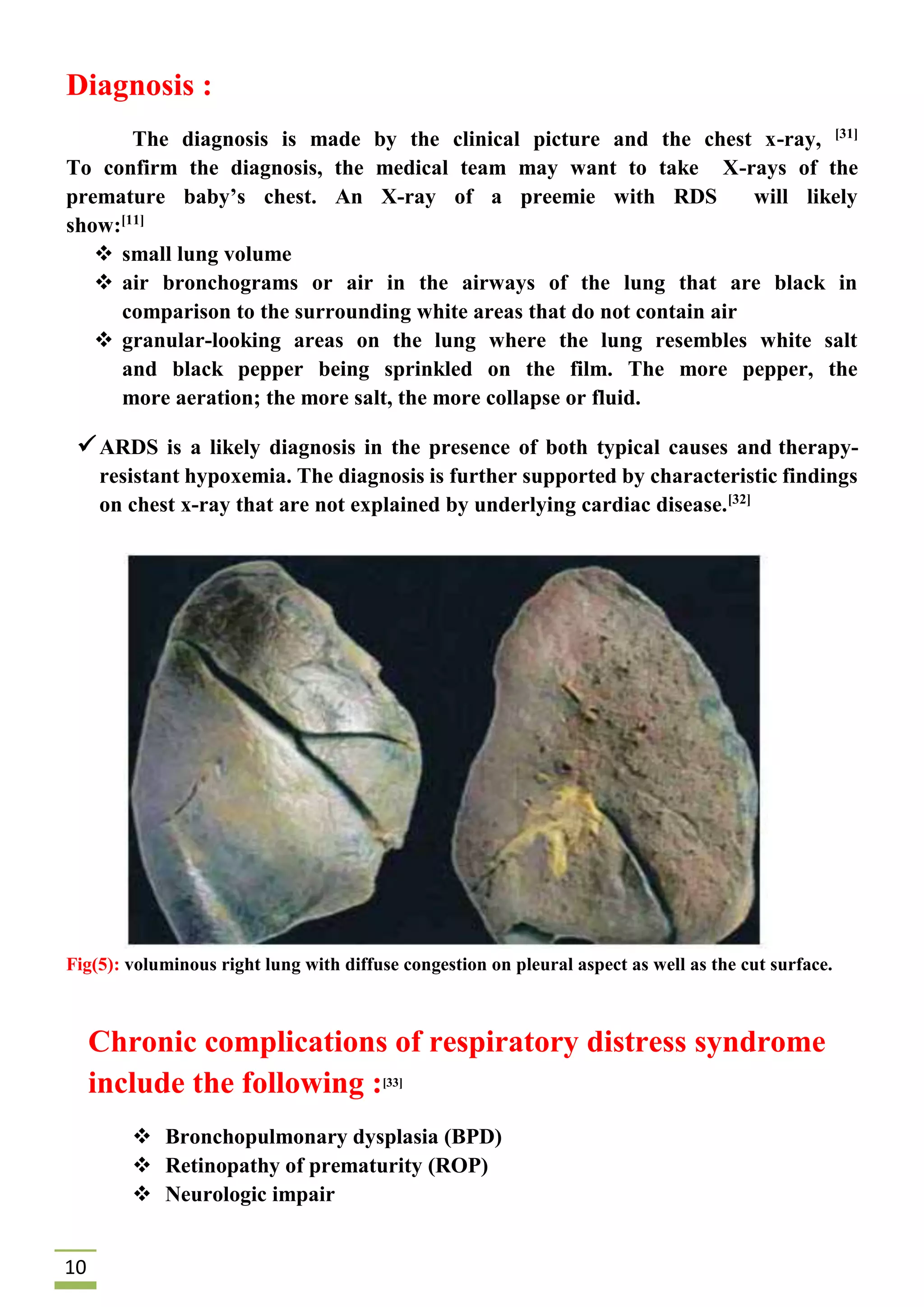 Respiratory distress syndrome 2018 | PDF