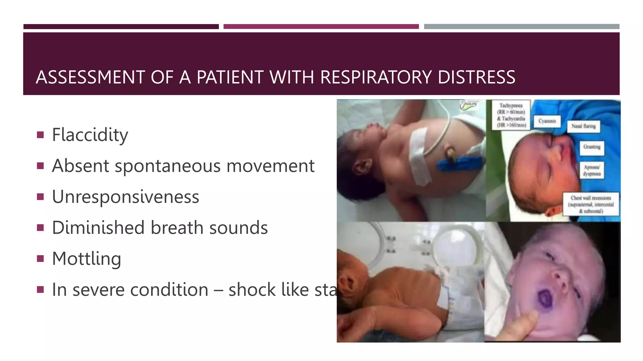 Respiratory Distress Syndrome by DR FAITHFUL DANIEL.pptx
