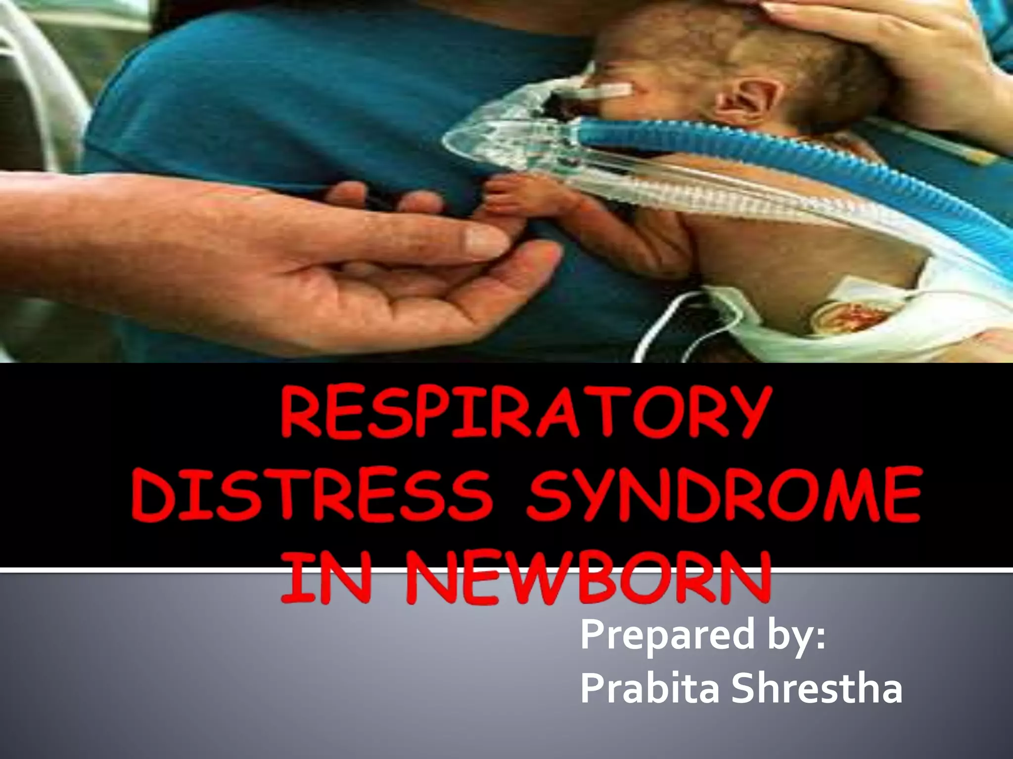 Respiratory distress syndrome (RDS) in newborn | PPTX | Lung and ...