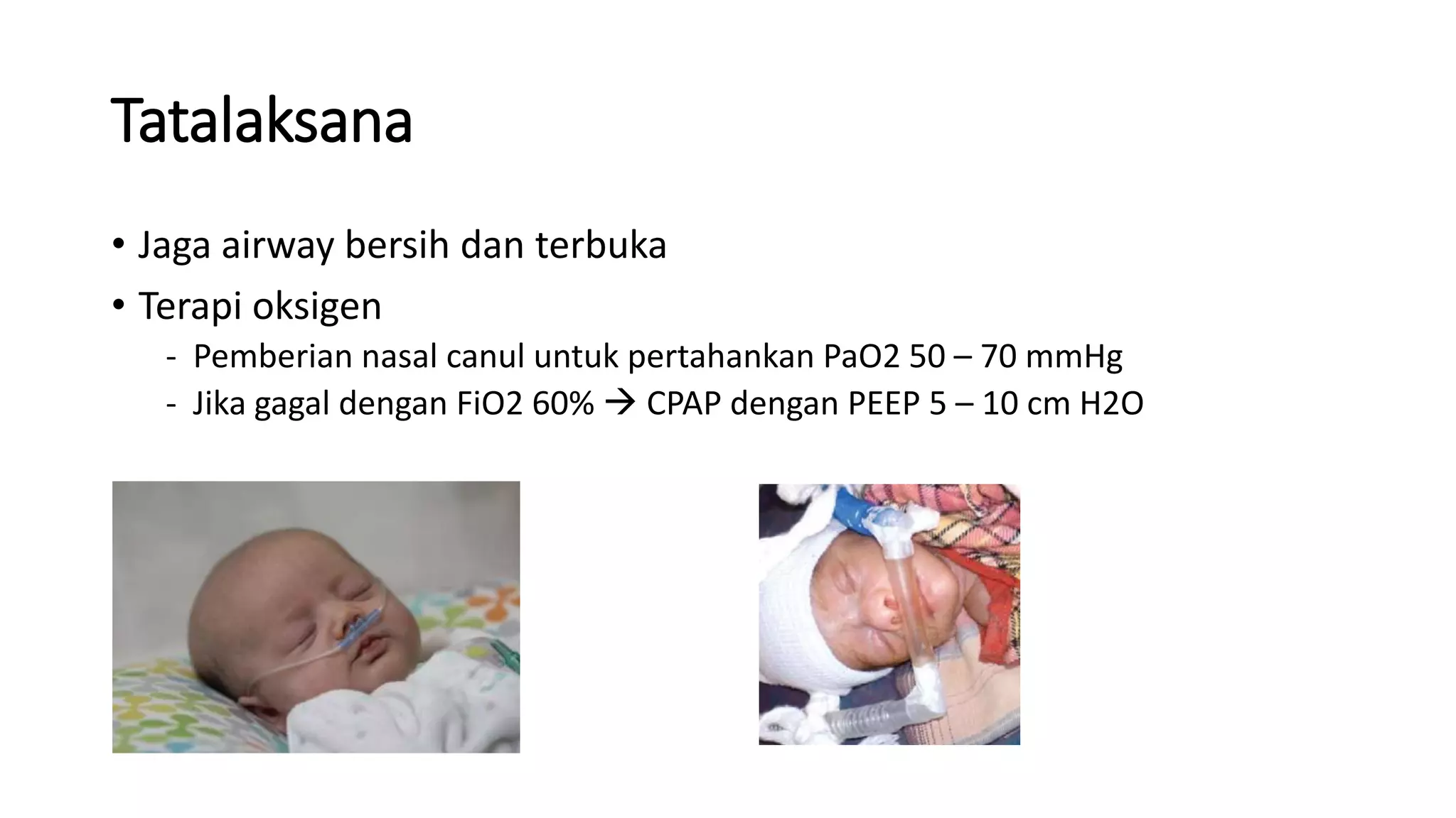 Respiratory Distress Syndrome (RDS).pptx