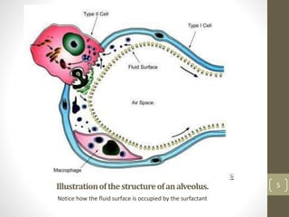 Respiratory distress syndrome [RDS] | PPTX | Lung and Respiratory ...