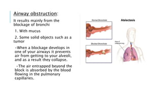 RESPIRATORY DISTURBANCE.pptx