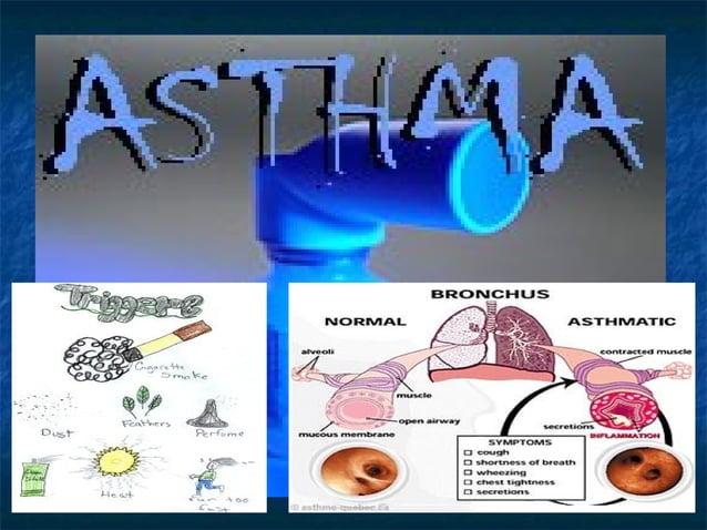 Respiratory Drugs | PPT