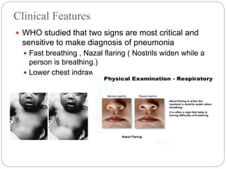 Respiratory Dysfunctions in Children ,.ppt