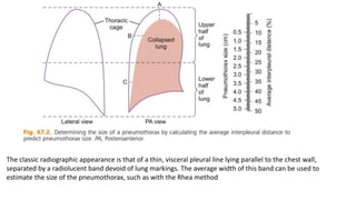 Respiratory emergencies Emergency medicine | PPTX