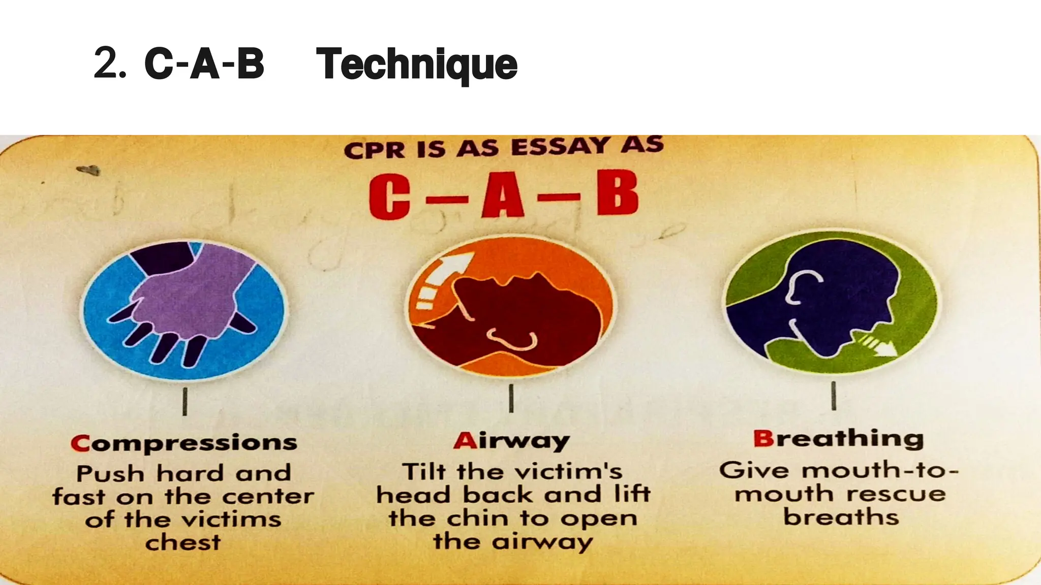 Cardiopulmonary resuscitation according to respiratory emergencies | PDF