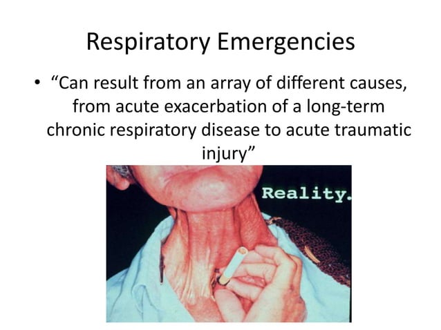 Basics of Respiratory Emergencies for ED Nurses! | PPTX
