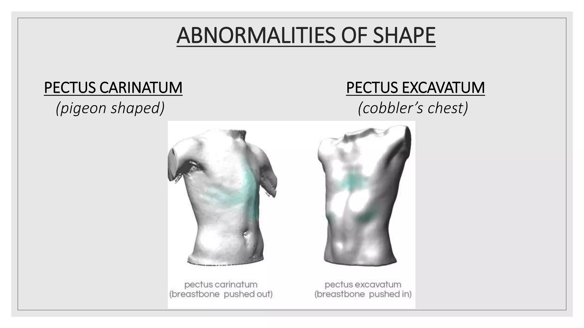Respiratory examination insp+palp | PPTX