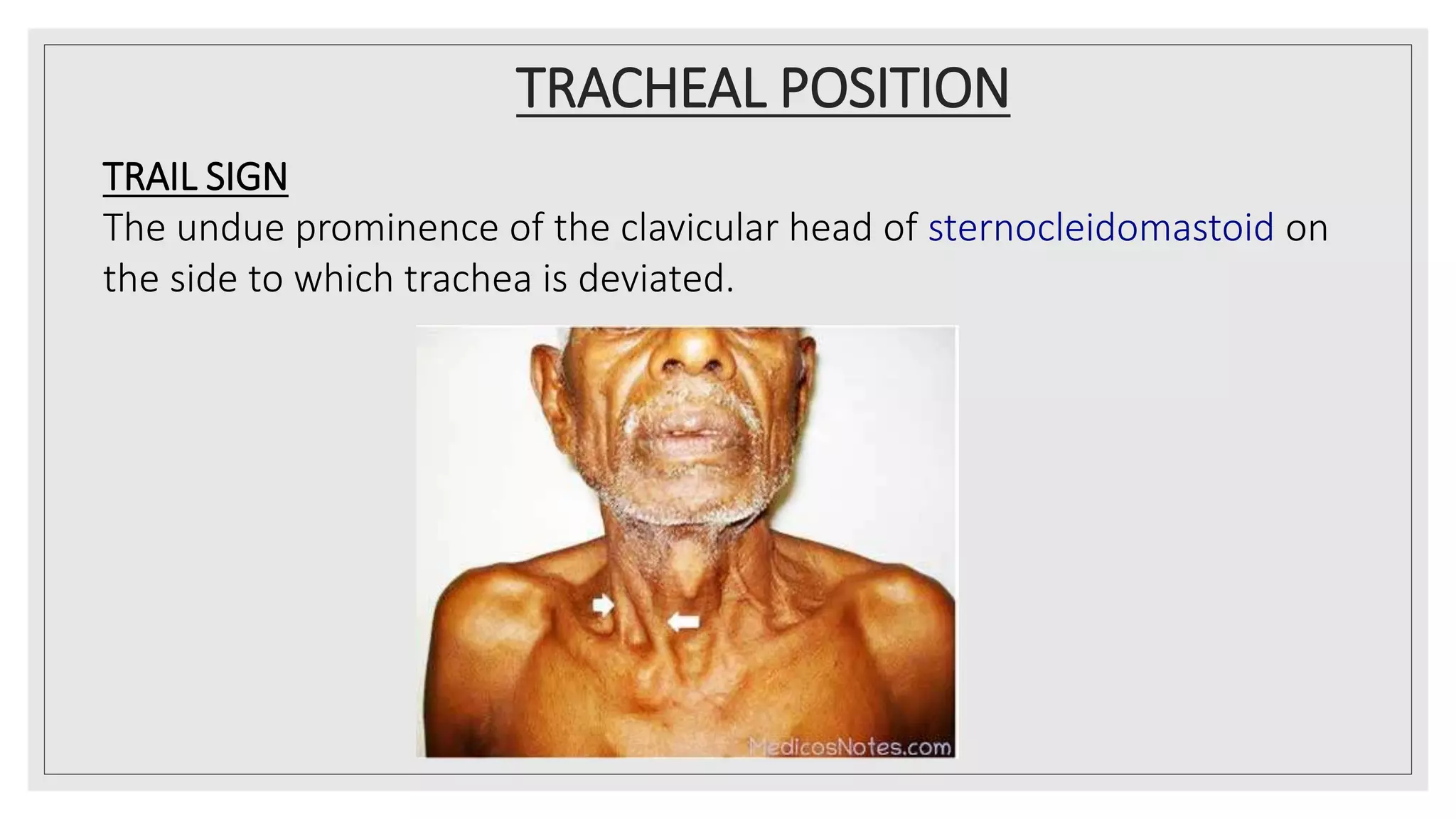 Respiratory examination insp+palp | PPTX
